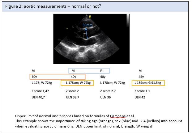How to measure the aorta in the setting of genetic aortic disease